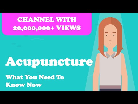 Acupuncture - What You Need To Know Now