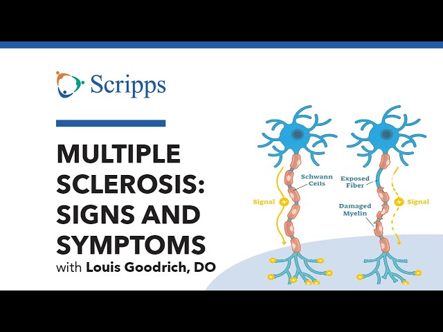 What Is Multiple Sclerosis And What Are The Symptoms Multiple