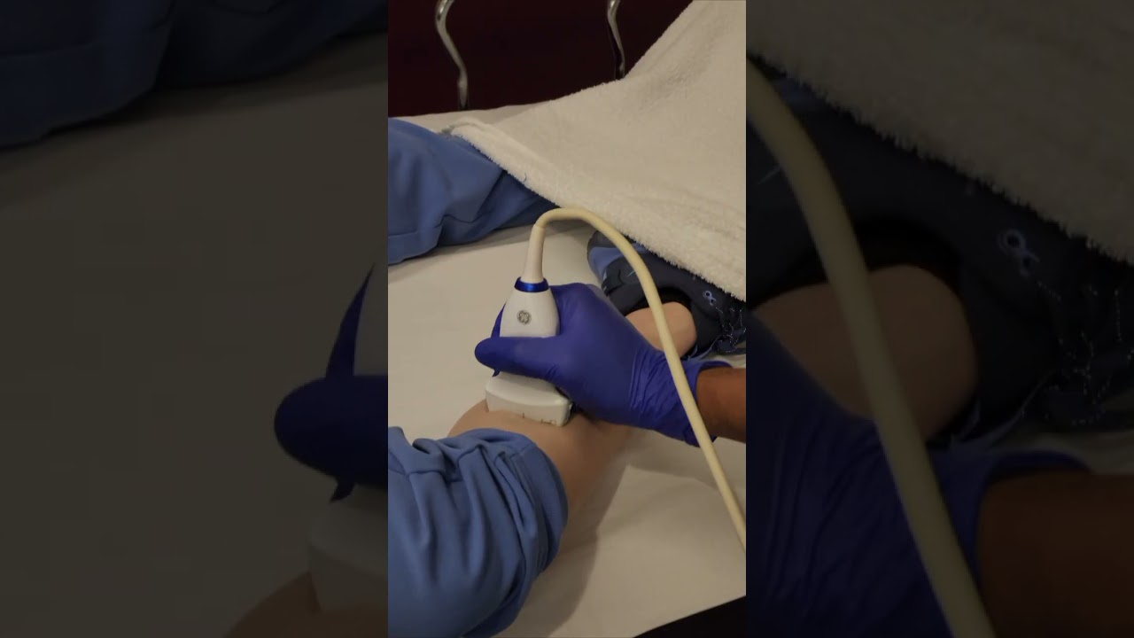 Finding the Posterior Tibial Vein and Peroneal Vein