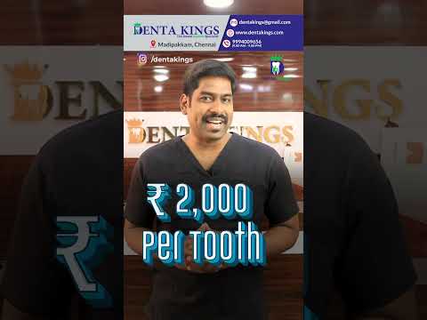 பல் வெனீர் வகைகள் மற்றும் அதன் விலை? Types and Cost of Dental Veneers | @DentaKings