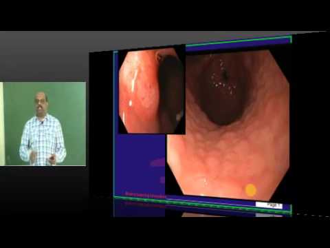 Helicobacter High yield Topic Microbiology for USMLE Step 1 prep www.anatomy2medicine.com