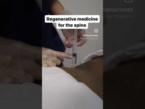 Regenerative medicine for the spine can help you avoid surgery for back pain