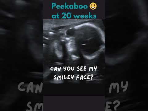 Ultrasound pregnancy Peekaboo π20 weeks. Can you see my smiley face?