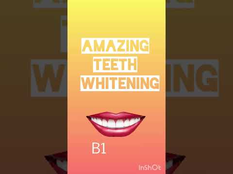 Teeth whitening LIVE DEMO; Dr. Srishti Bhatia