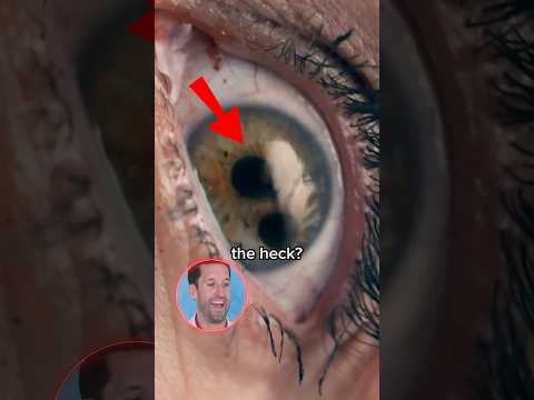 ER Doctor REACTS to The Substance (2024) Movie