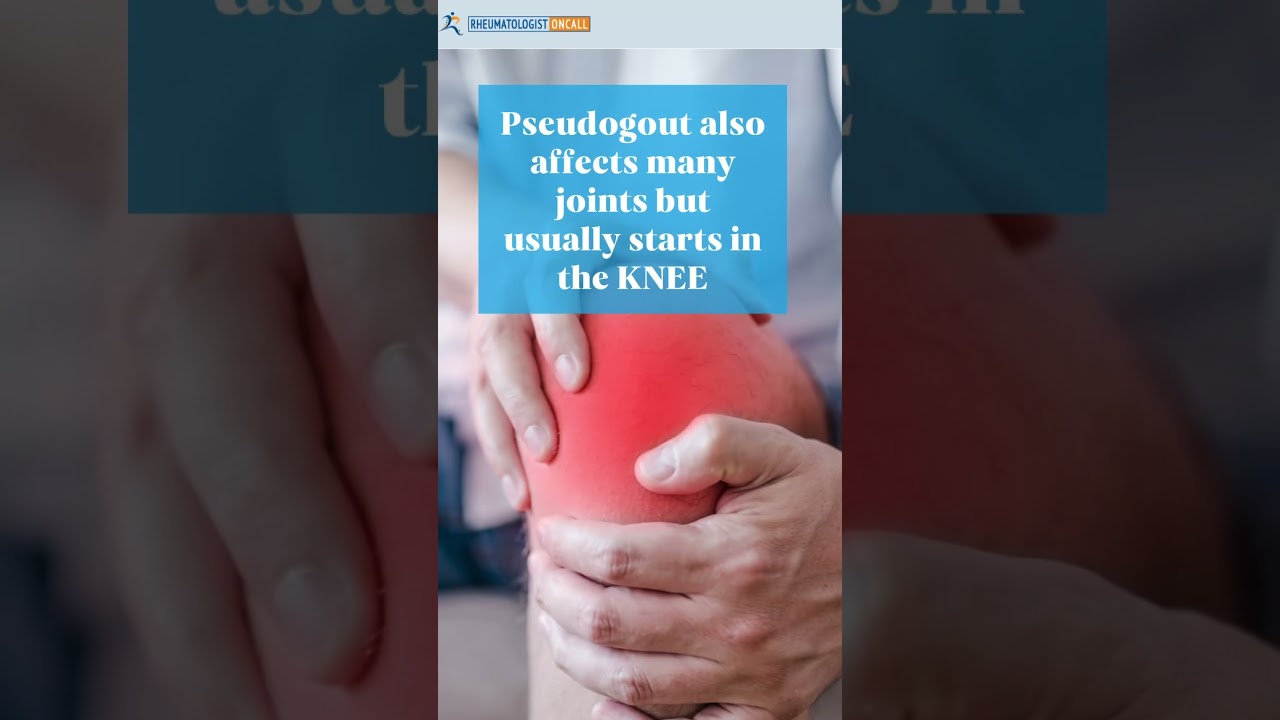 #gout vs #pseudogout what is the difference?