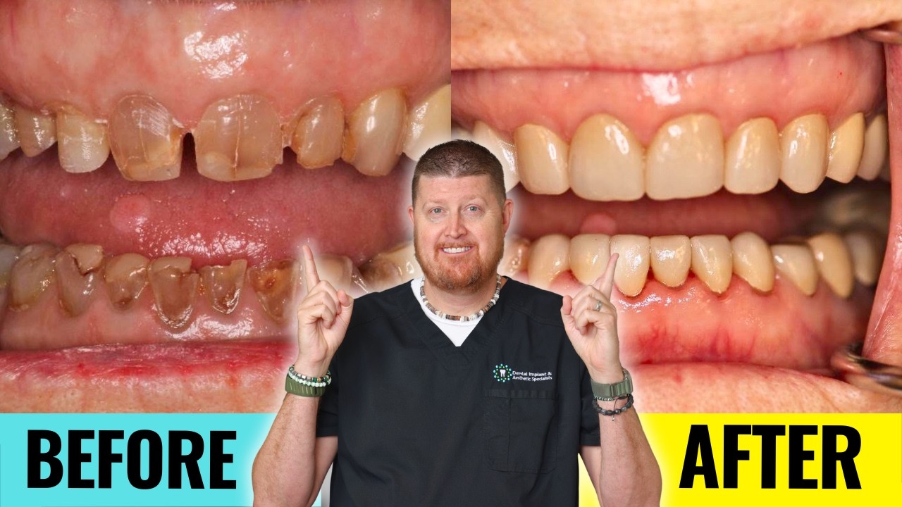 Smile Makeover Process & Timeline | What You Need to Know