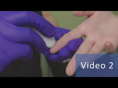 Blood Glucose Testing and Log Sheets | Managing Childhood Diabetes