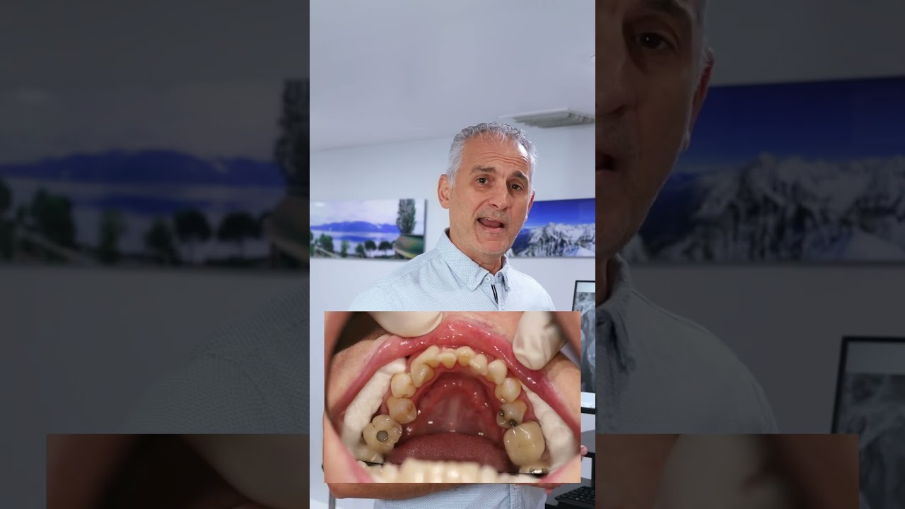 Your Dentist. Your first line of defense for sleep breathing problems #sleepapnea #sleep #breathing