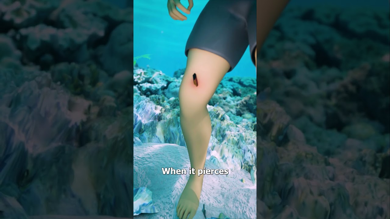 How Stingrays Actually Sting You 😳