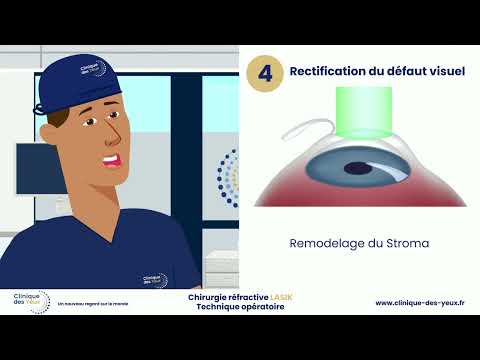 Chirurgie Réfractive Laser - Clinique des Yeux