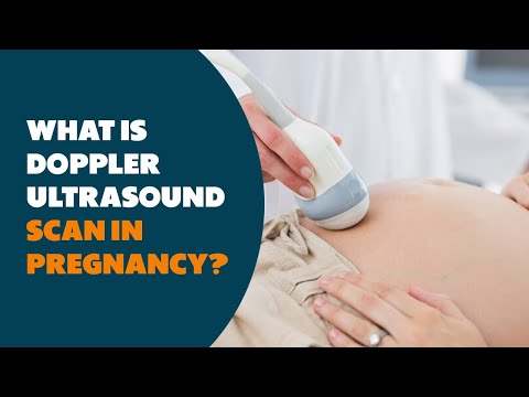 What is Doppler Ultrasound scan in Pregnancy? #pregancy #pregnancyscan #doppler #ultrasoundscan