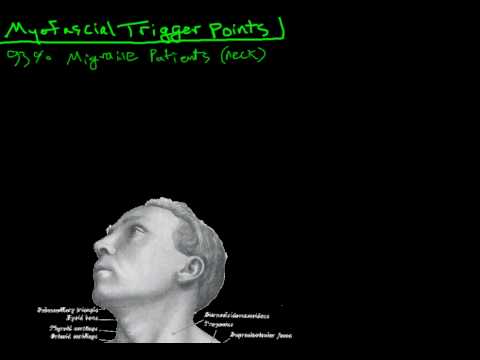 Myofascial Trigger points: Introduction