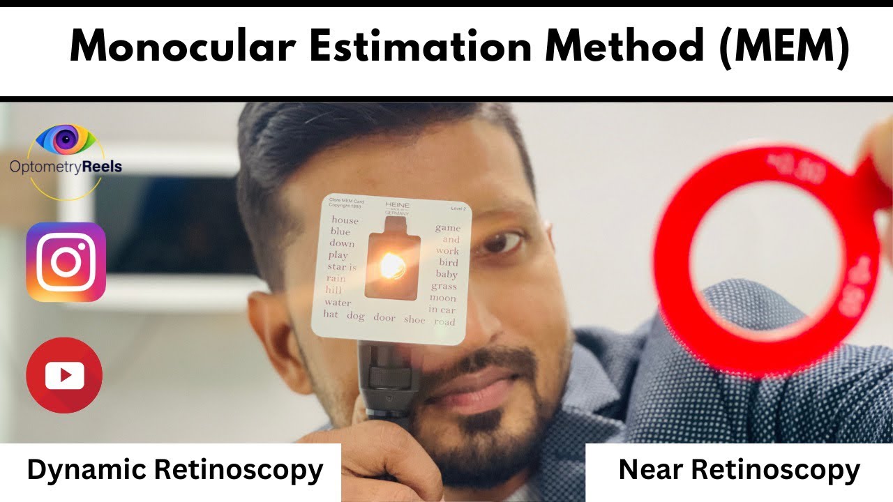 How to perform MEM? || Dynamic Retinoscopy || Near Retinoscopy @optometryreels
