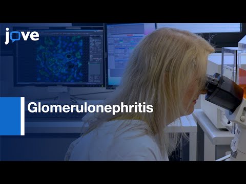 Semi-Quantification of DNA in Glomerulonephritis | Protocol Preview