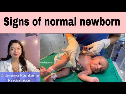 Newborn- normal vitals | heart rate | breathing | temperature | the baby doctor