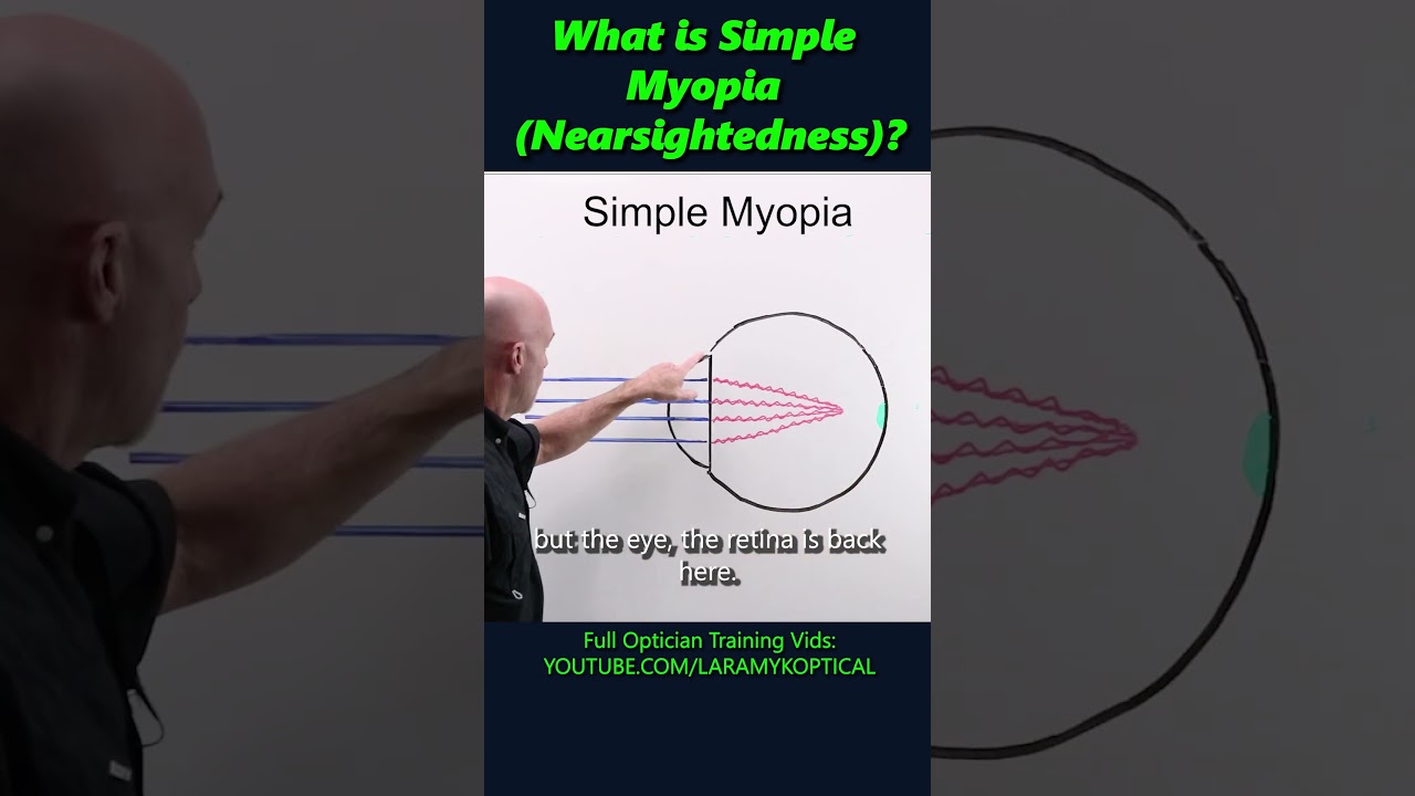 What is simple Myopia (Nearsightedness)?