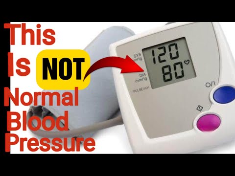 120 OVER 80 IS NOT NORMAL/New Blood Pressure Guidelines 2024.