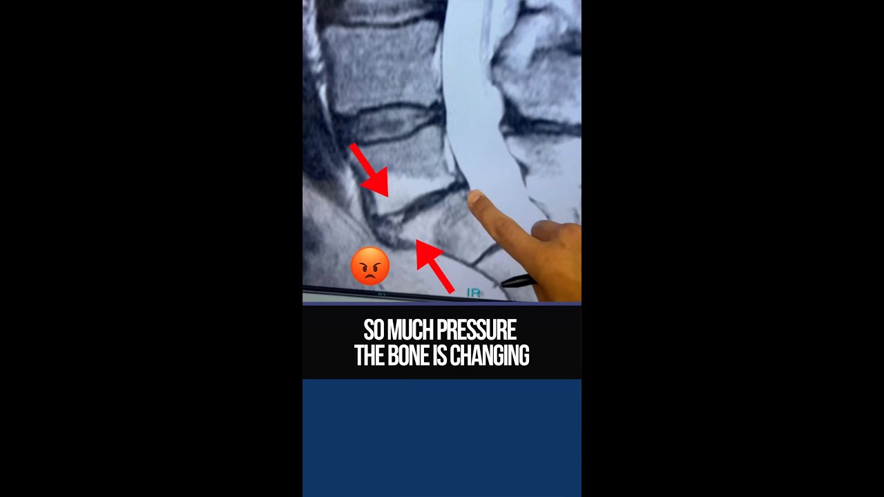 Why is my nagging lower back pain not getting better.