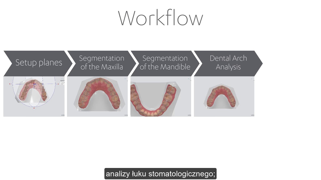 3Shape Clear Aligner Studio Workflow PL