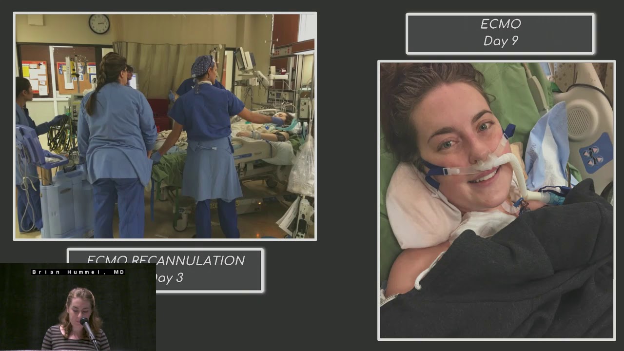 When The Beat Stopped: Living On ECMO