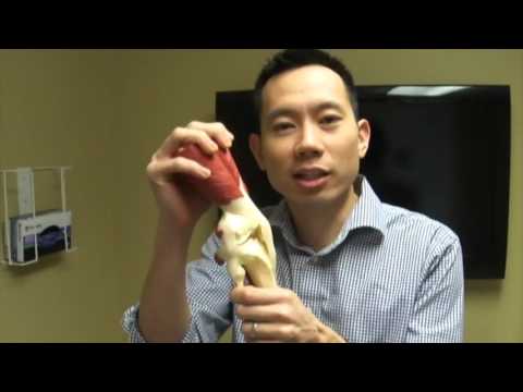 Jumper's Knee - Northeast Spine & Sports Medicine