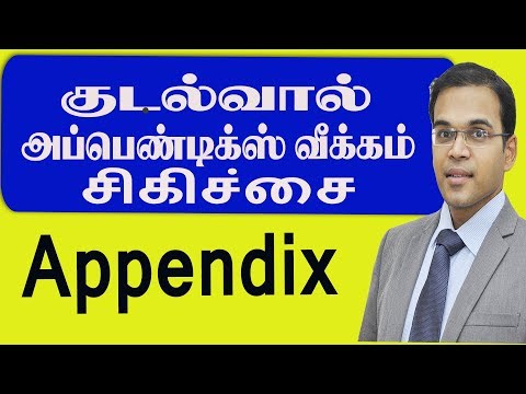 Appendix Laparoscopy Treatment குடல்வால் அப்பெண்டிக்ஸ் வீக்கம் சிகிச்சை Laparoscopic Surgical Center