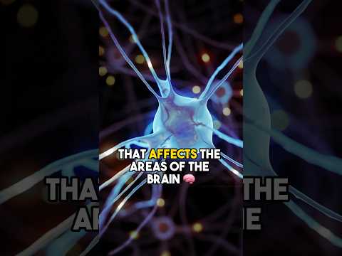 What is Alzheimer’s disease? 🧠🤔 #neuroscience #medicine #neuro #brainhealth #alzheimer #doctor