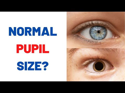 Are your pupils normal size?