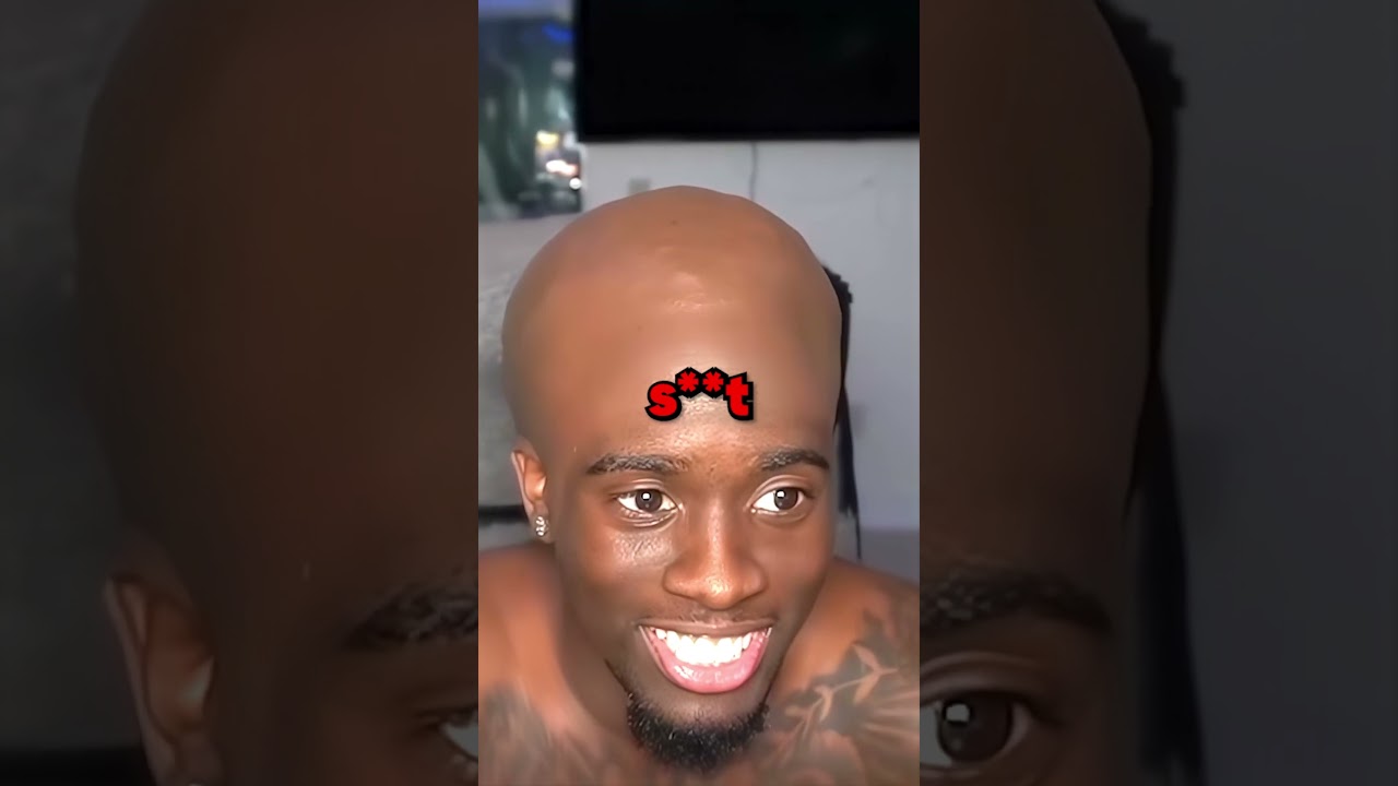 Streamers With Giant Foreheads 🧠