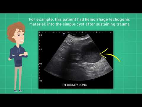 Does a simple kidney cyst require follow up? | POCUS pearls