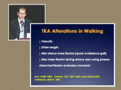 Weaknesses of Total Knee Replacement - The Art of Balancing in TKA - Part 1 of 3