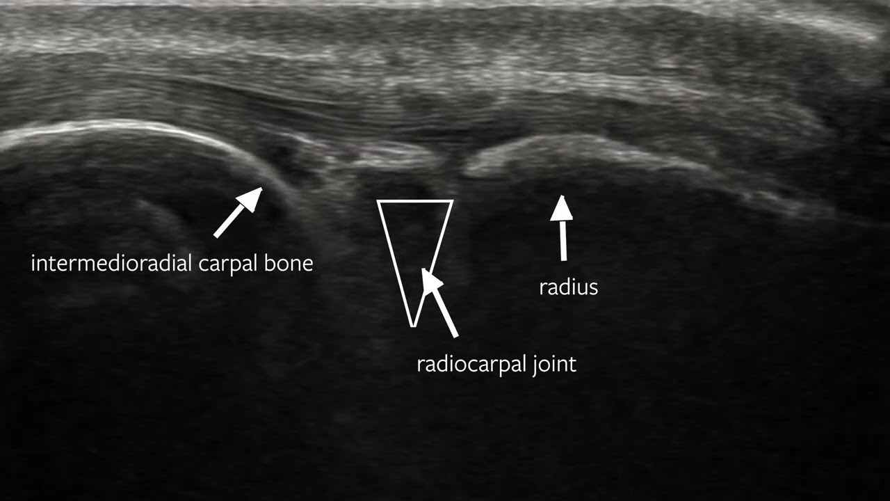 Ultrasound-Guided Joint Injections and Arthrocentesis in Dogs