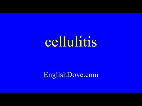 How to pronounce cellulitis in American English