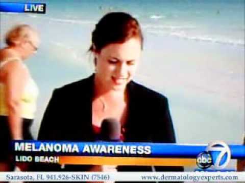 Sarasota Dermatologist Dr. O'Donoghue On ABC 7