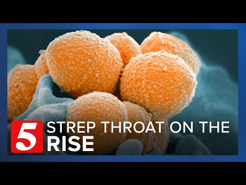 Strep throat is on the rise in the US