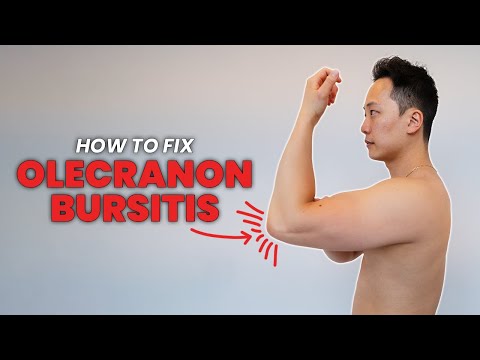 How to do exercises for Olecranon Bursitis - One cause of elbow pain in the triceps region