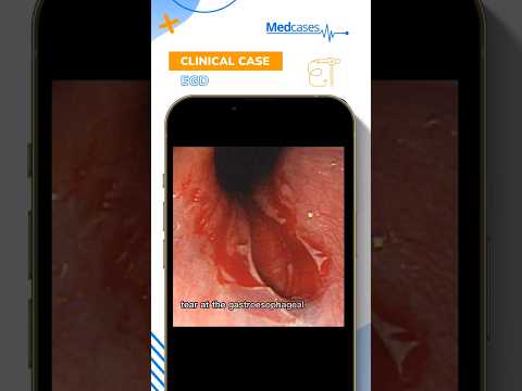 Bloody vomiting?! - clinical case #meded #usmle #medschool #medicine #medstudent medst