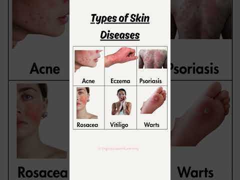 Types Of Skin Diseases ✅✍️✨#english #educationalvideo #grammer #englishgrammar #education