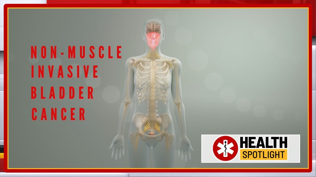 New gene therapy gives hope in fighting bladder cancer