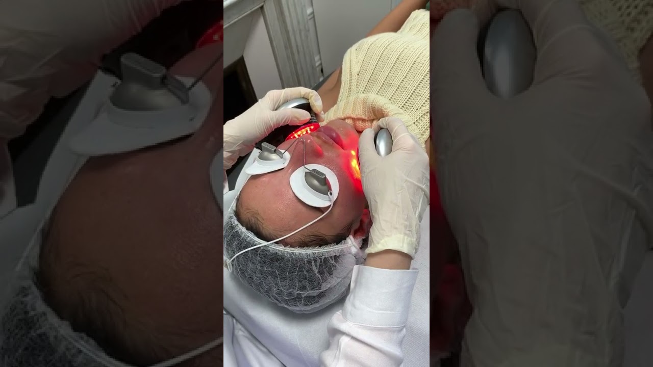 Les étapes du soin Hydrafacial : le soin de la peau n°1 aux USA