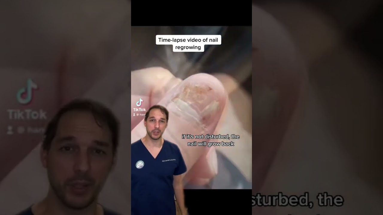 Hand surgeon Nick Pappas MD discusses nail growth #acrylicnails #Nail #Regrow #Medical #Hand #Finger