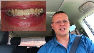 3 Best Dentists in Springfield, MO - Expert Recommendations