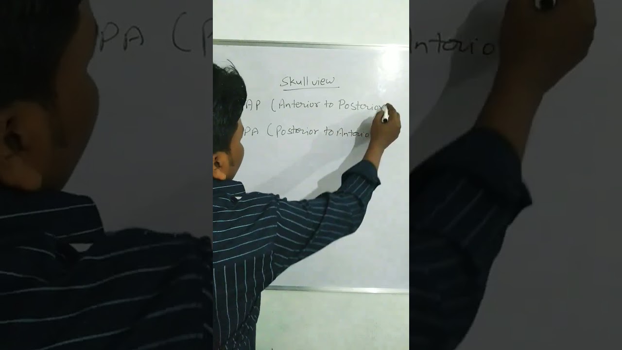 skull views X-ray radiography #papular #radiology #viral