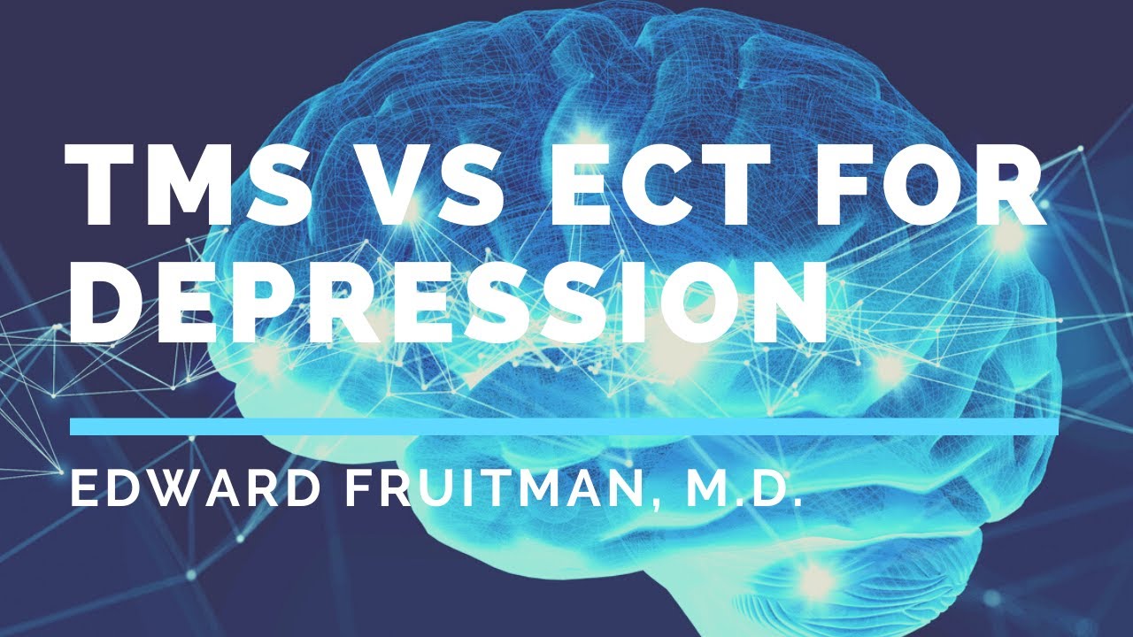 TMS vs ECT For Depression