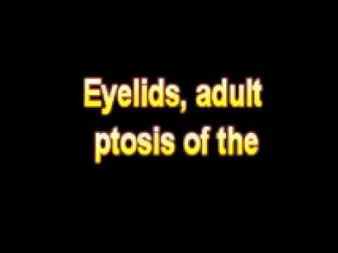 What Is The Definition Of Eyelids, adult ptosis of the - Medical Dictionary Free Online