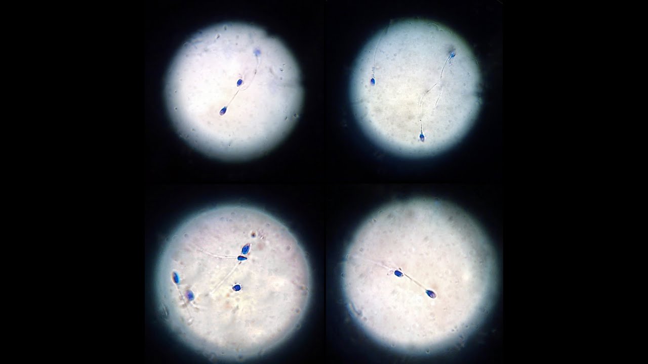 Spermatozoa Structure and Function V 80