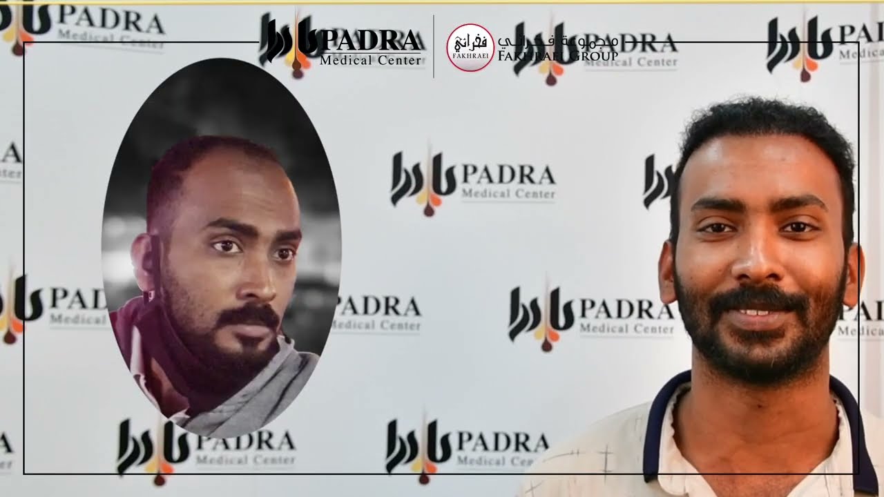 Padra – Padra Medical Center Hair Transplant in Dubai