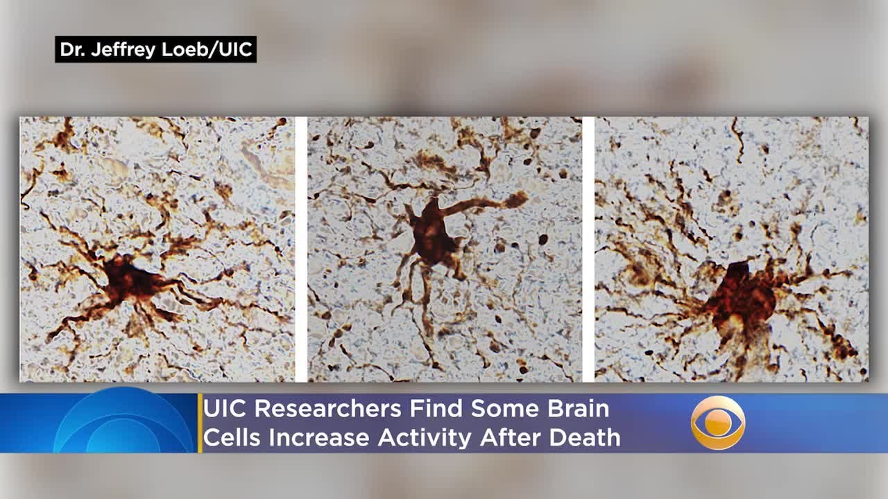 'Zombie Genes'? UIC Researchers Find Some Brain Cells Increase Activity After Death
