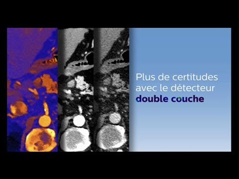 Scanner Philips : IQon Spectral CT